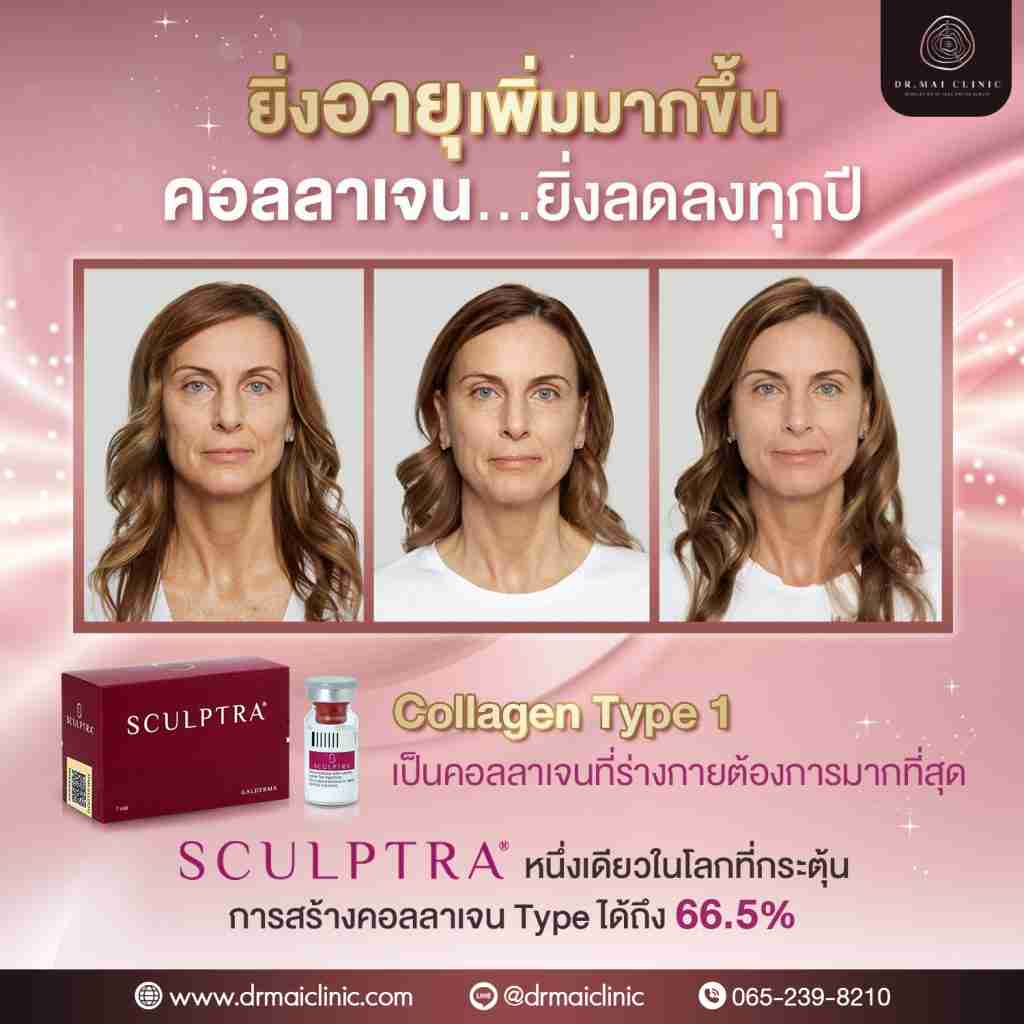 Sculptra ตัวช่วยคืนชีพ ผิวอ่อนเยาว์ที่ดีกว่า - Dr.Mai Clinic เชียงใหม่